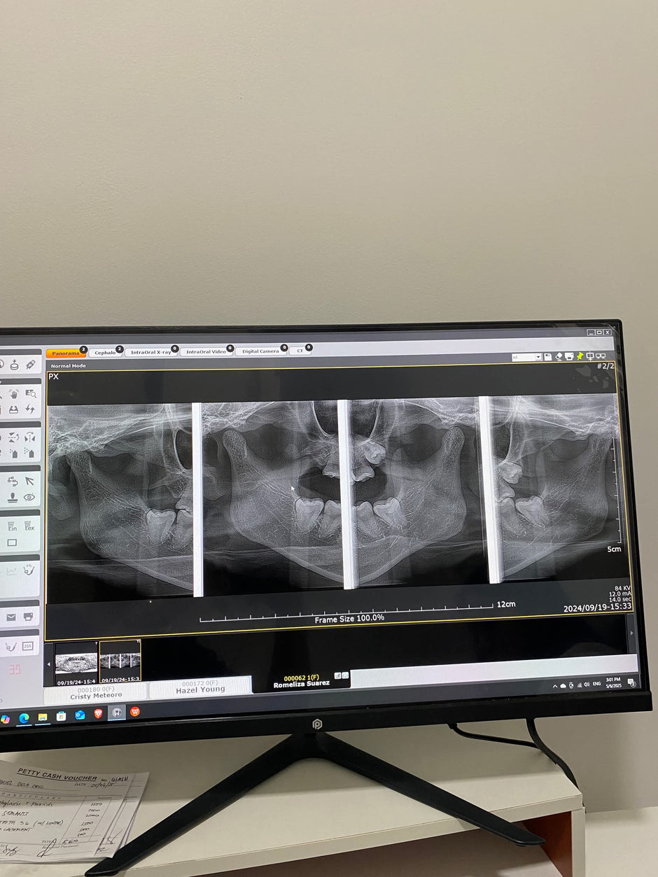 Radiograph – Easethetic Dental Lounge
