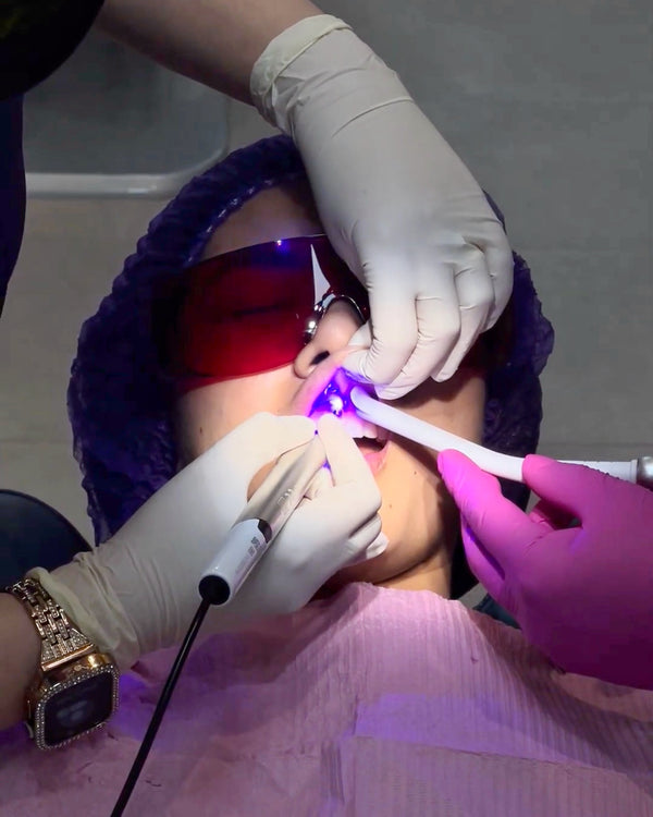 Frenectomy Lip Tongue Tie Release Quezon City Clinic Easethetic